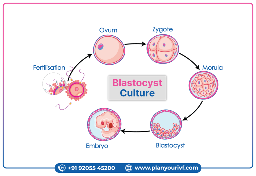 Blastocyst Culture - Planyourivf