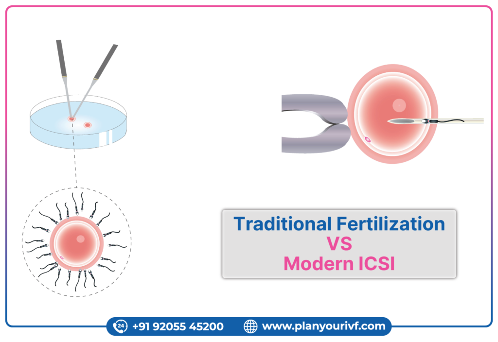 Traditional Fertilization vs. Modern ICSI - Planyourivf