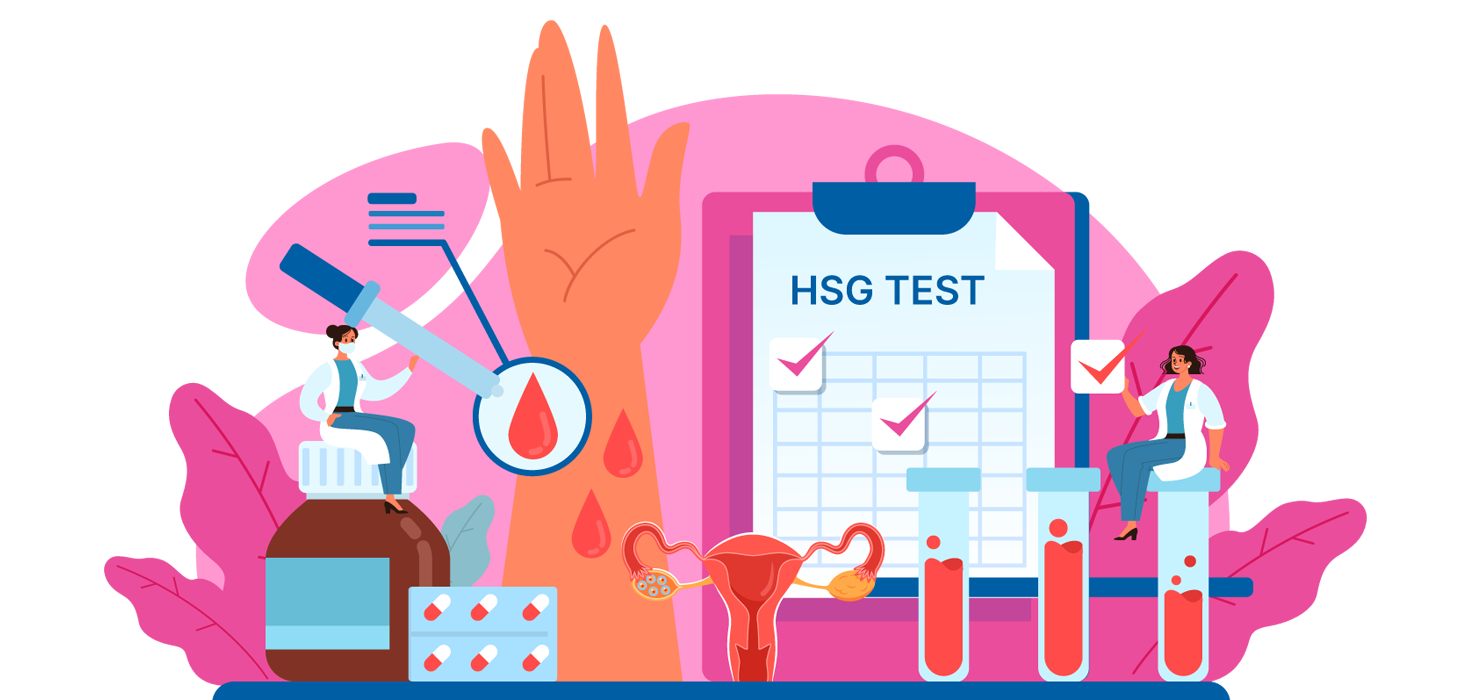 Hysterosalpingogram (HSG) Test - Planyourivf